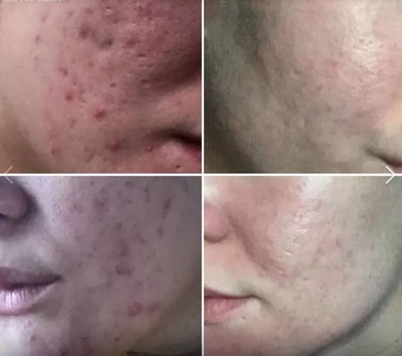 1635712822308544512%2F1d4f56ea5733b42ab671812ee5ab9cec